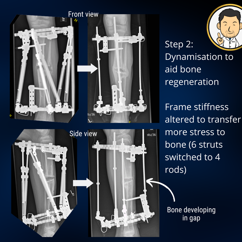 Circular Frame Treatment