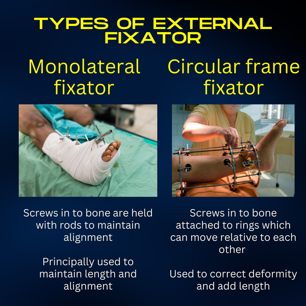 Circular Frame Treatment